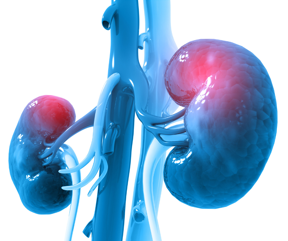 What your Stem cells can do for your Kidneys - Stemregen – Stemregen APAC